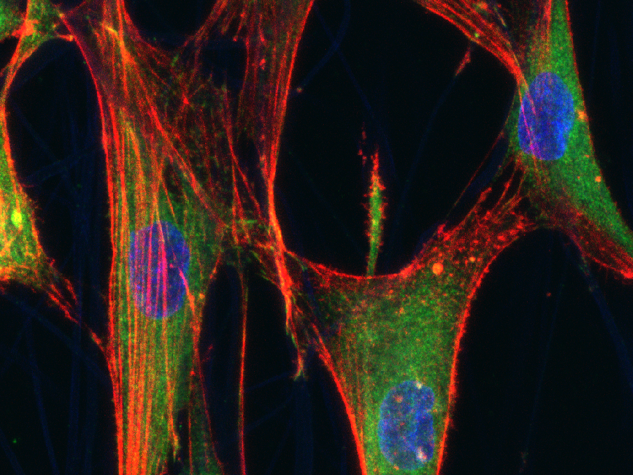 Biomaterials and Interface Tissue Engineering Lab